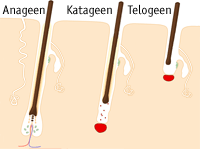 Haar en hoofdhuidproblemen - Haarwerk Instituut Nederland | Haarwerken ...